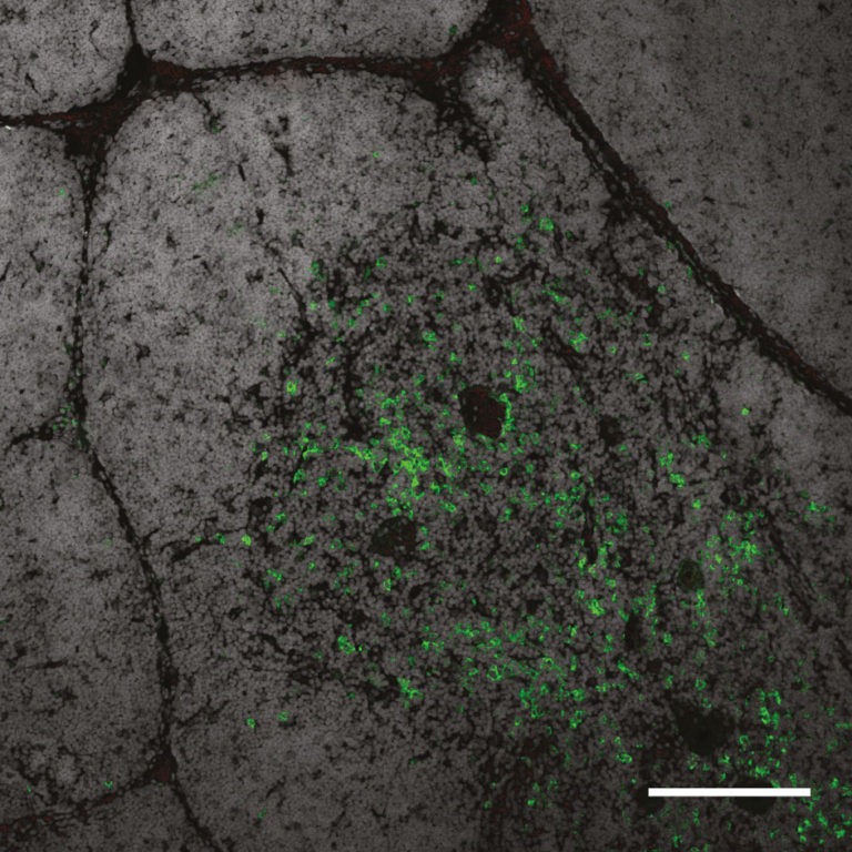B-celler i brässen kan lära T-celler skilja kroppsegna från främmande ämnen