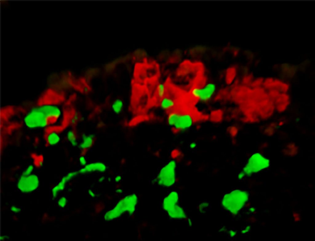 Nya fynd om B-celler i tarmen viktigt för vaccinforskningen